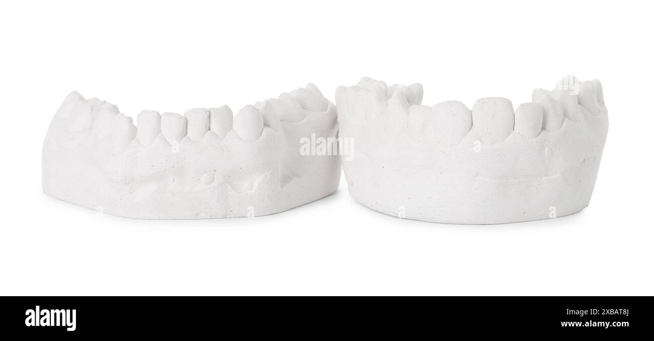 Dental model with gums isolated on white. Cast of teeth Stock Photo - Alamy