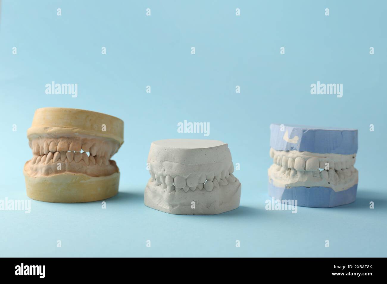 Dental models with gums on light blue background. Cast of teeth Stock ...
