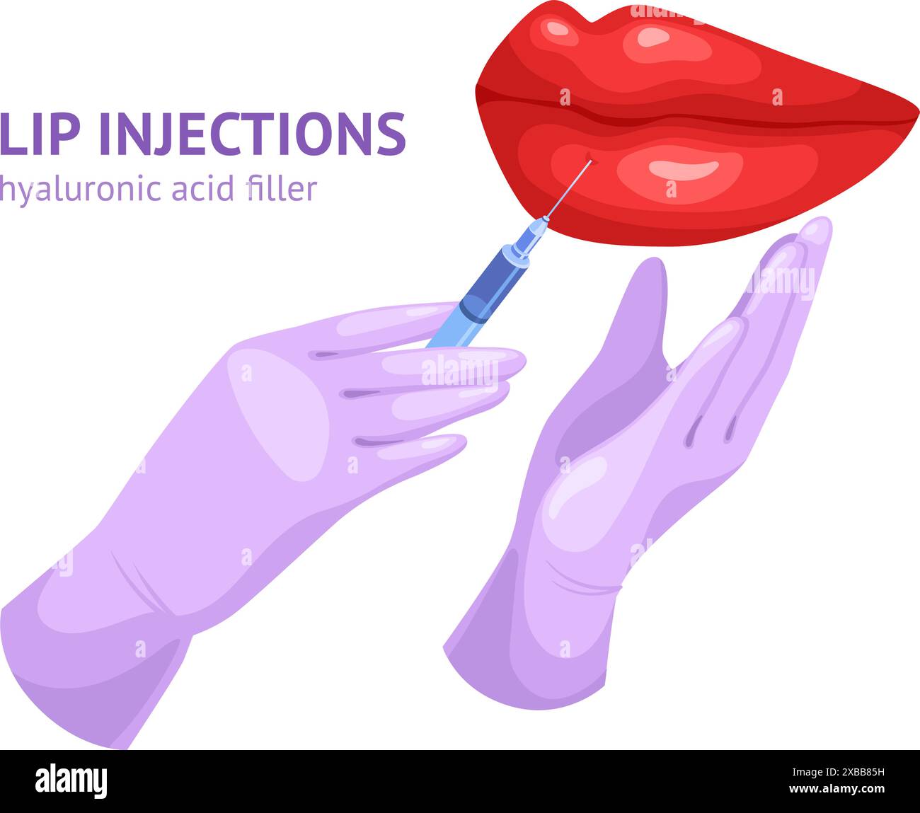 Lip injection. Lips fillers injectables, botox syringe injecting needle ...