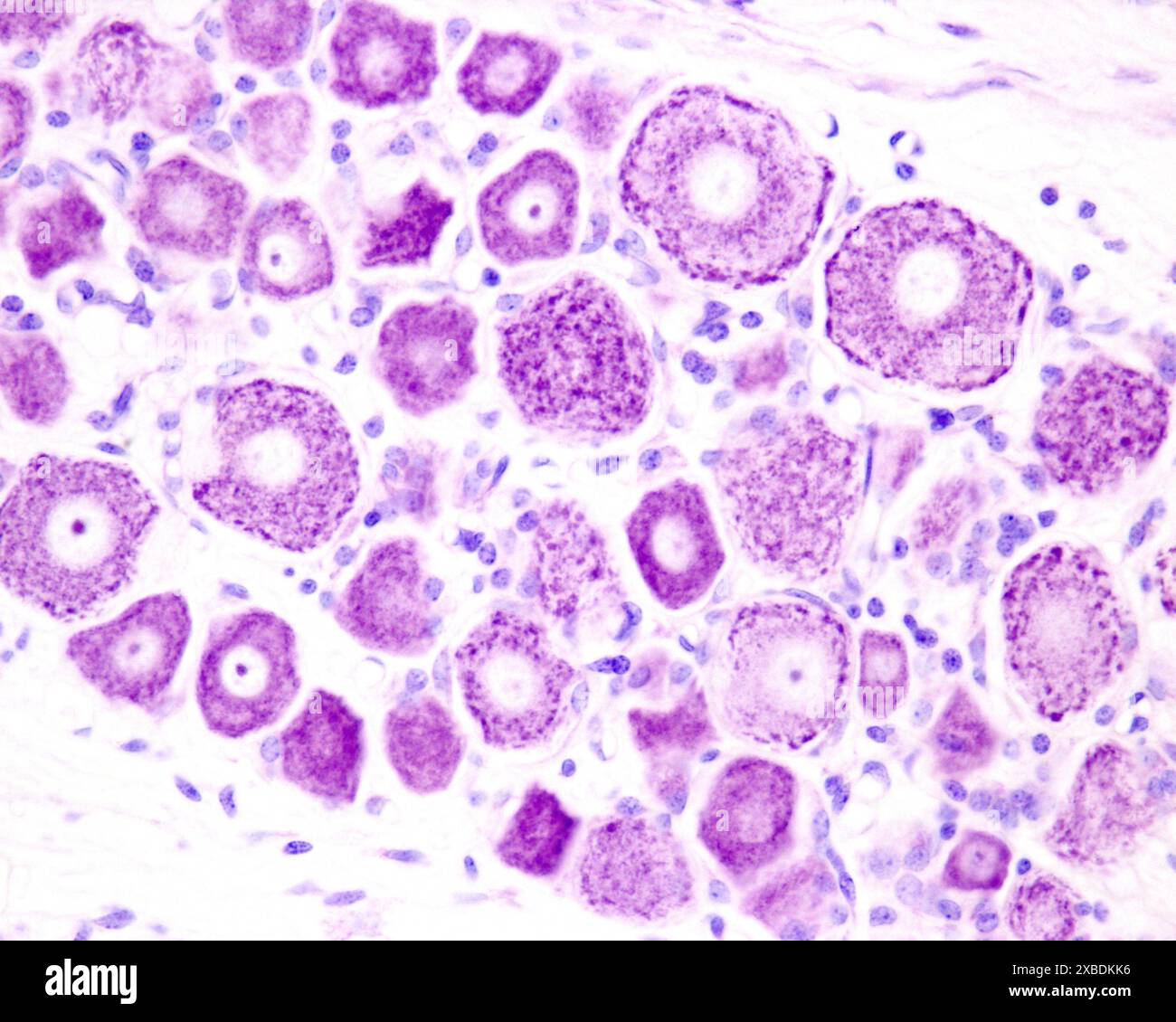 Light micrograph showing neurons (nerve cells) in a dorsal root ...