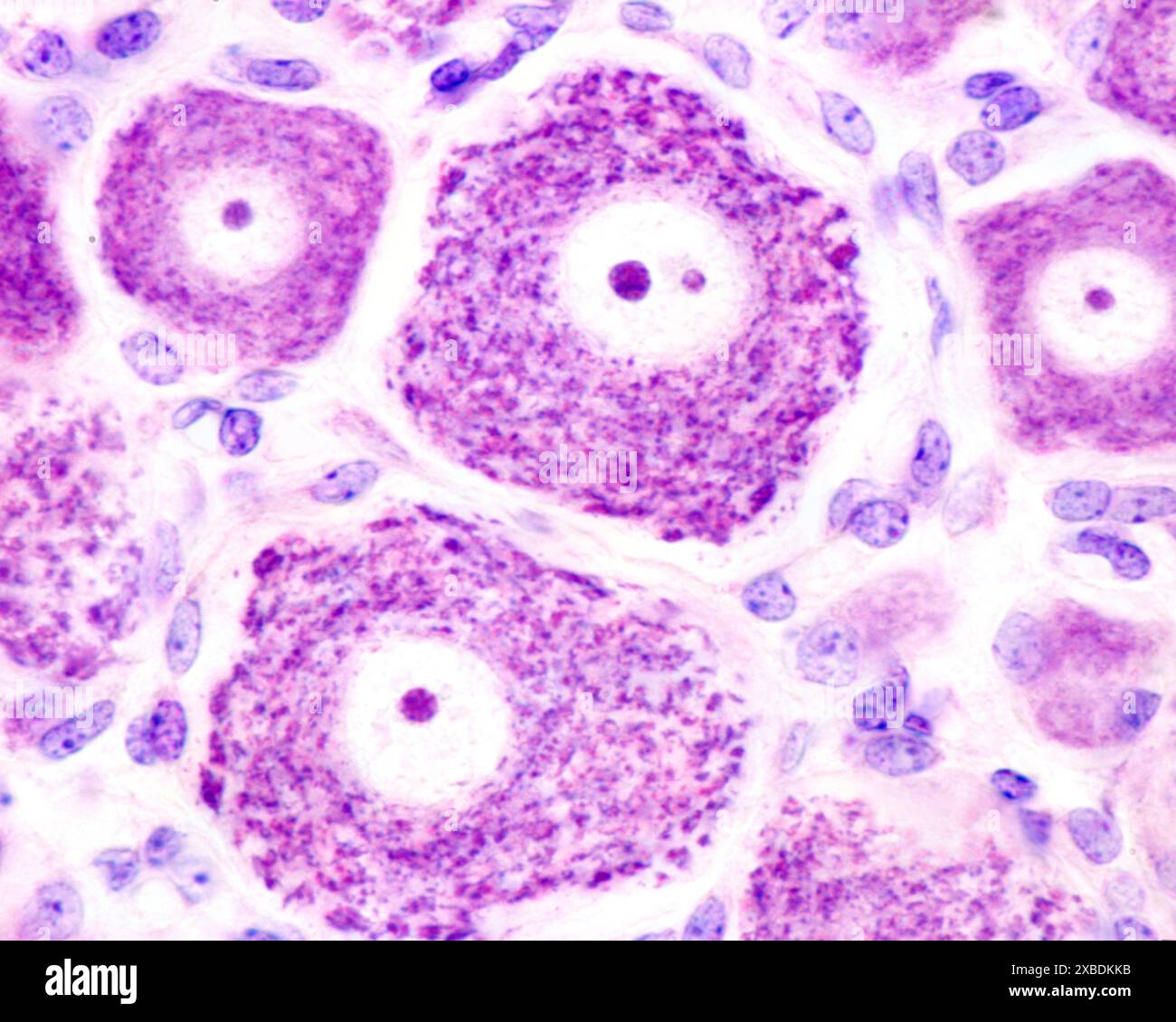 Light micrograph showing the cell body of dorsal root ganglion neurons ...