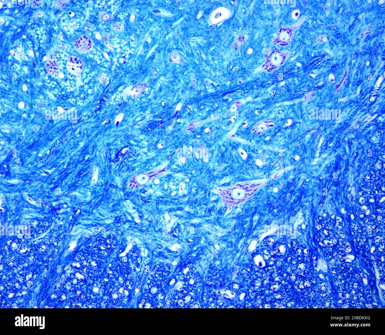 Light micrograph of the ventral horn of a cross-sectioned spinal cord ...