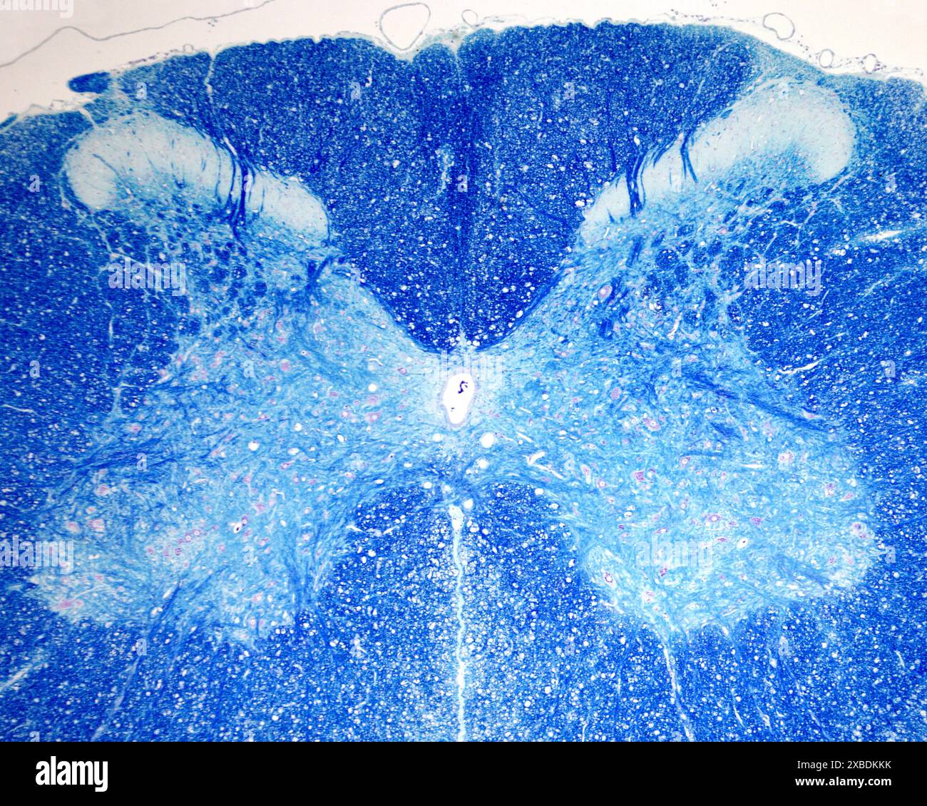 Cross-sectioned cervical spinal cord, light micrograph. The central ...
