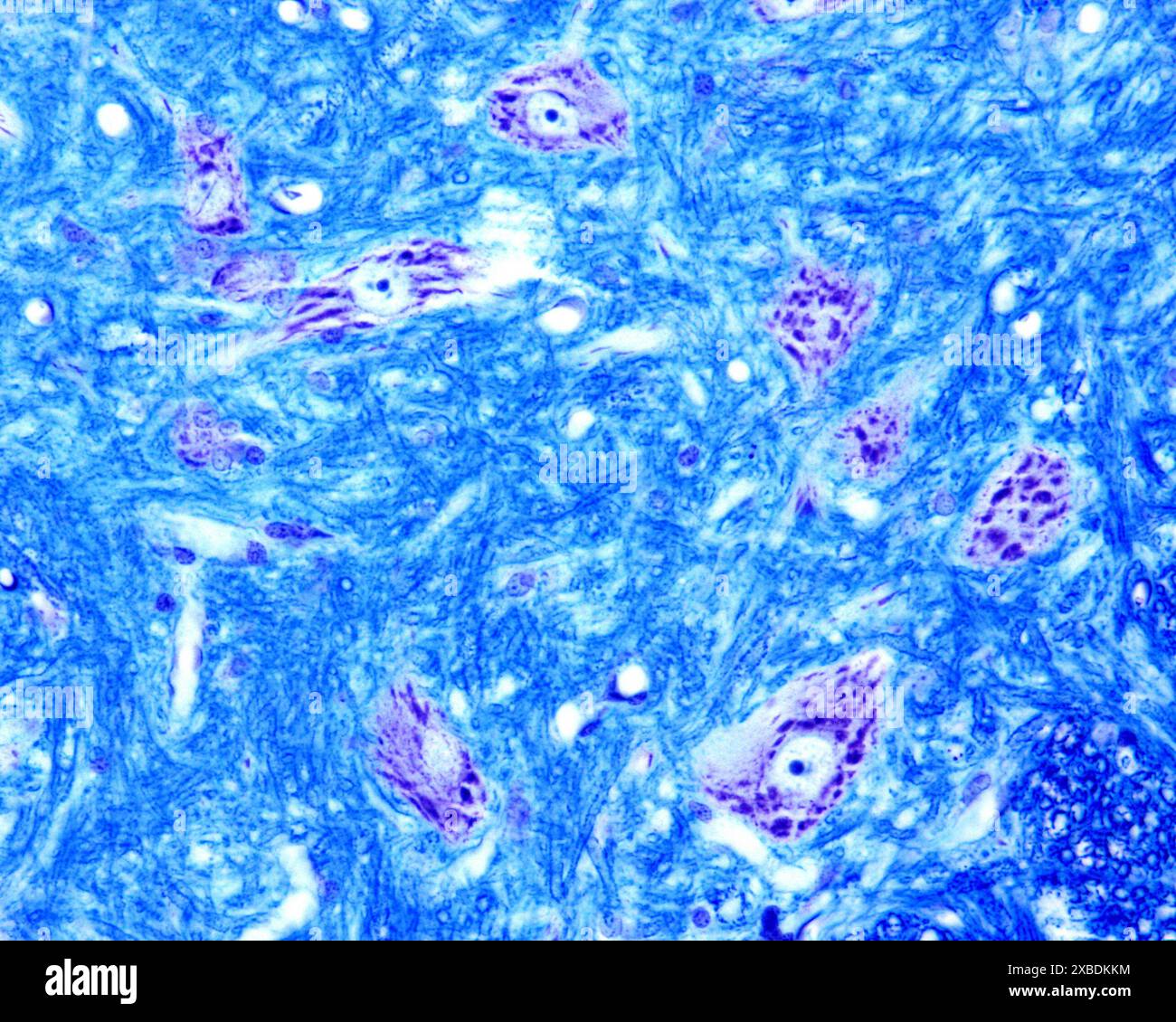 Light micrograph of the ventral horn of a cross-sectioned spinal cord ...