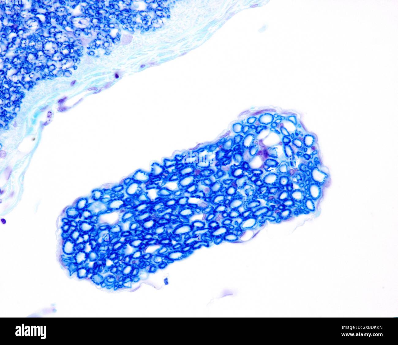 Light micrograph of a cross-sectioned spinal root showing myelinated ...