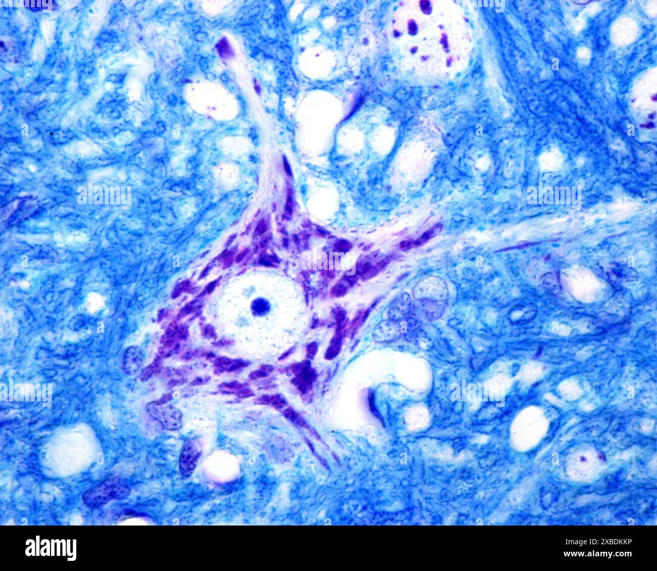 Light micrograph of a motor neuron (nerve cell) showing Nissl bodies of ...