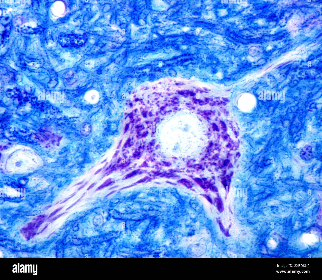 Light micrograph of a motor neuron (nerve cell) showing Nissl bodies of ...