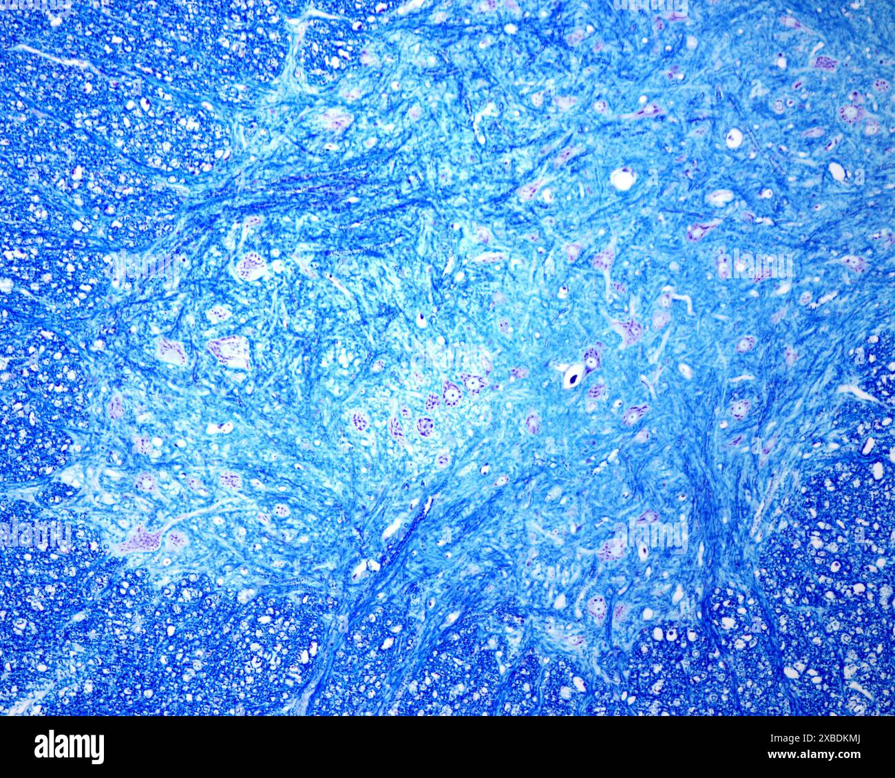 Light micrograph of the ventral horn of a cross-sectioned spinal cord ...