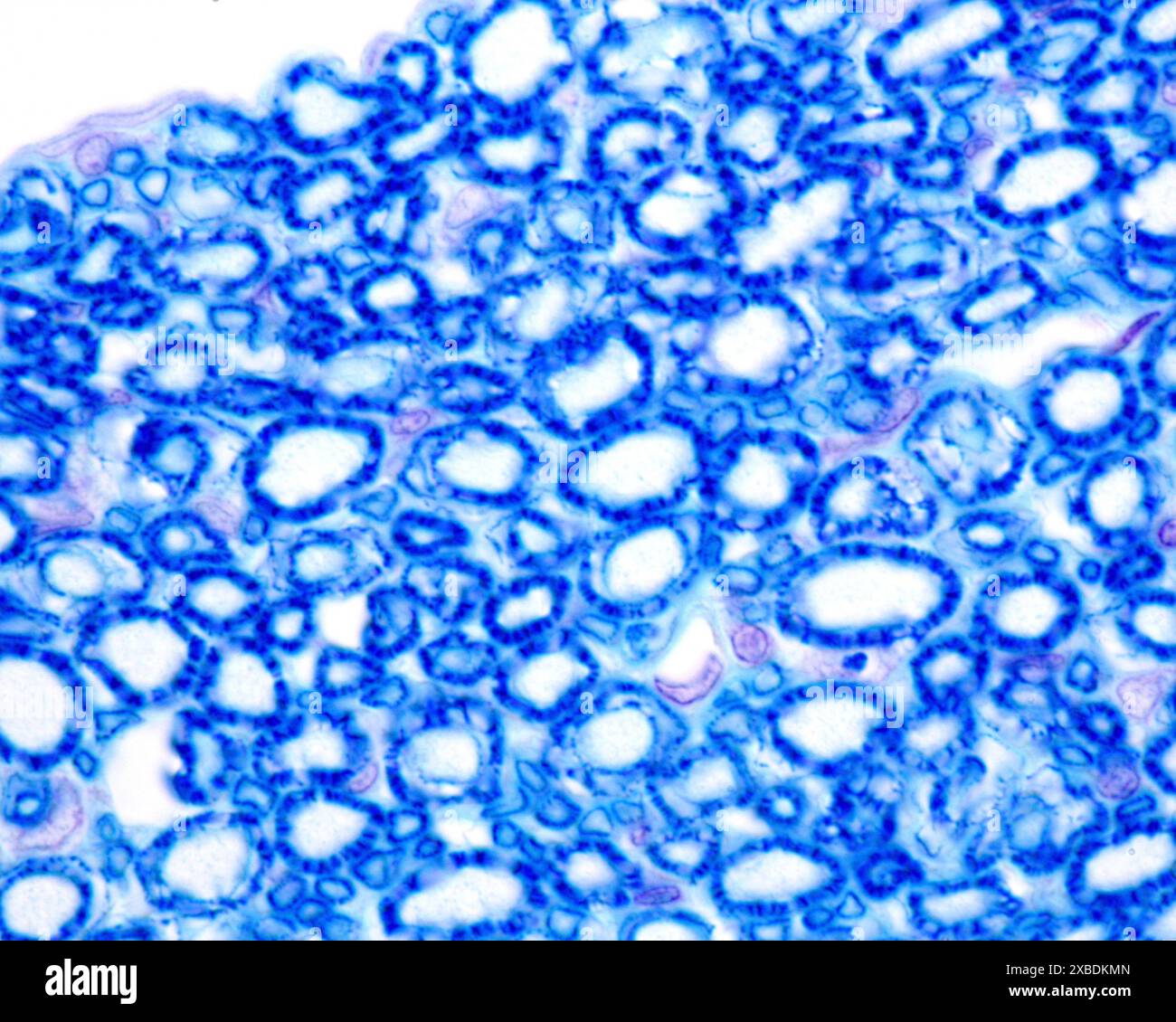 Light micrograph of a cross-sectioned spinal root showing myelinated ...