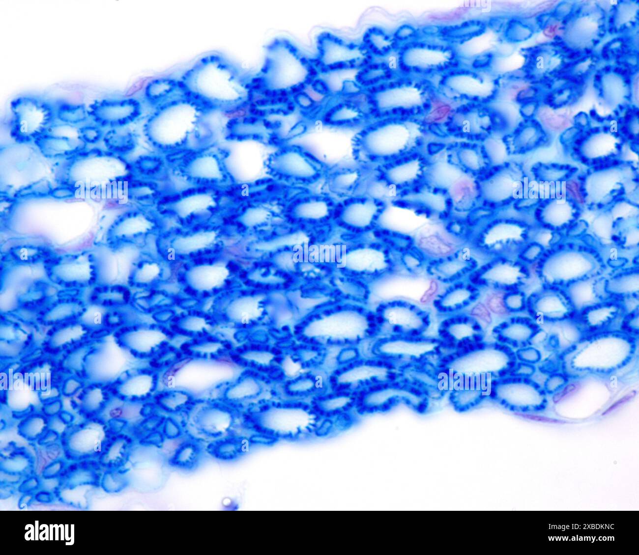 Light micrograph of a cross-sectioned spinal root showing myelinated ...