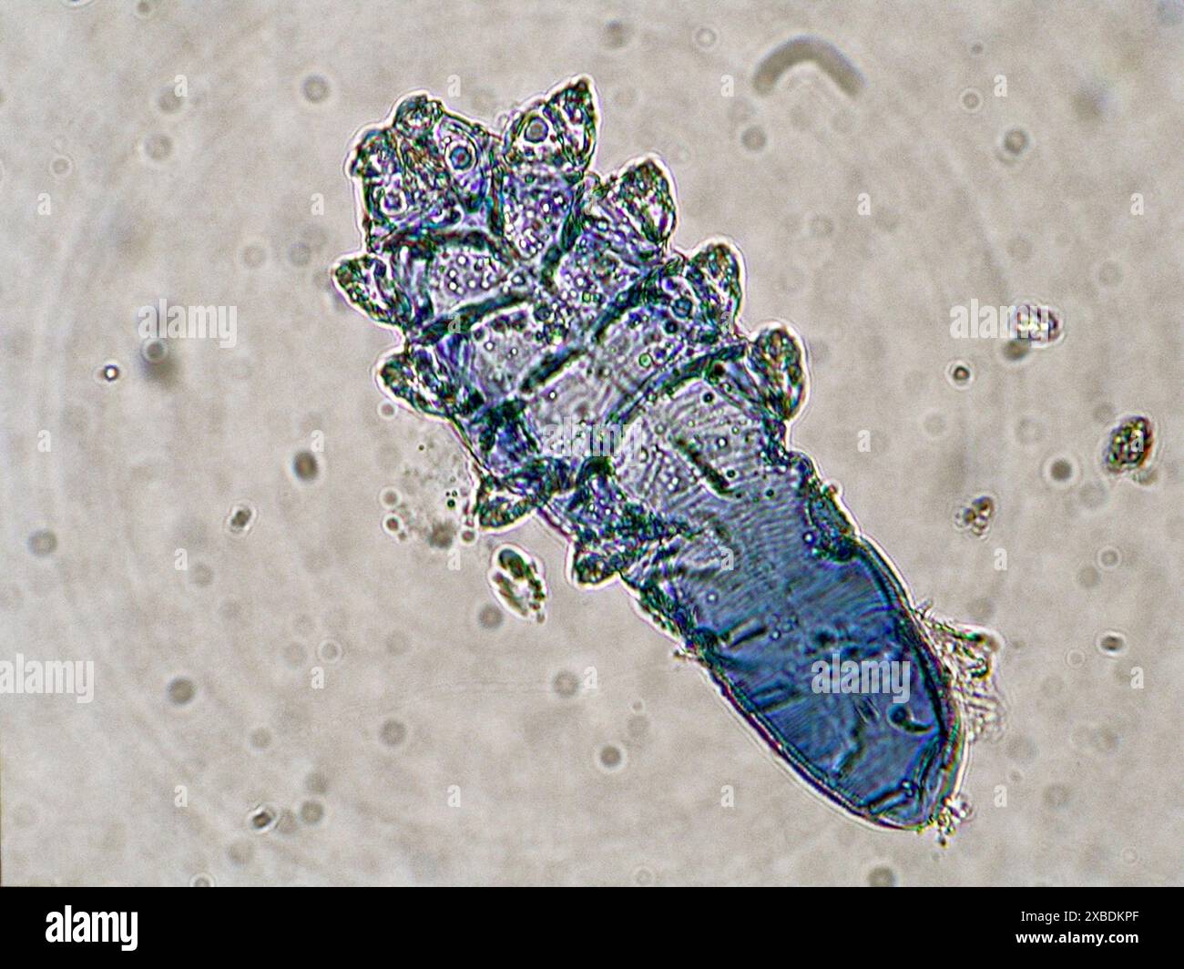 Light micrograph of a human hair follicle mite (Demodex sp.). This ...