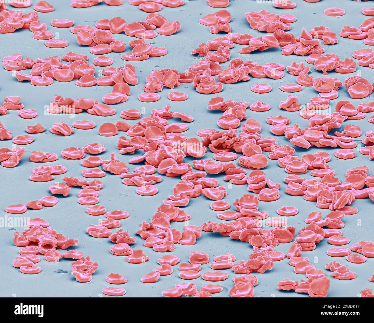 Red blood cells. Coloured scanning electron micrograph (SEM) of red ...