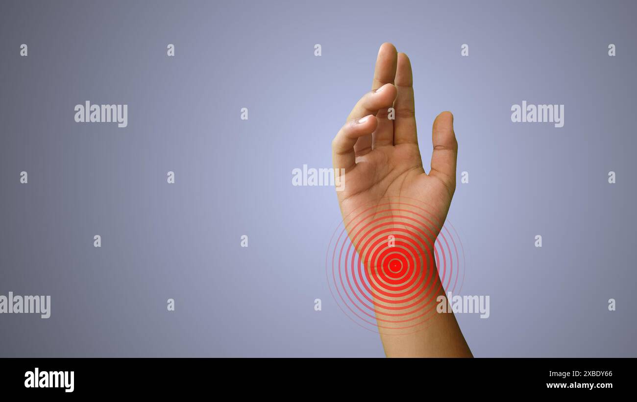 Hand tingling and numbness for the purpose Stock Photo - Alamy