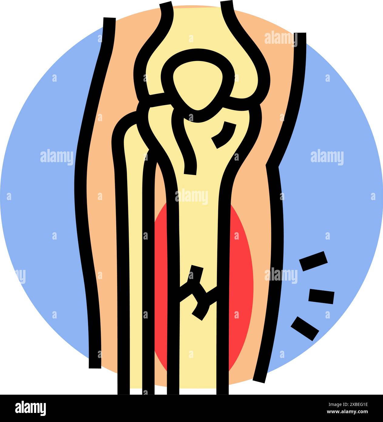 fractures household injury accident color icon vector illustration ...