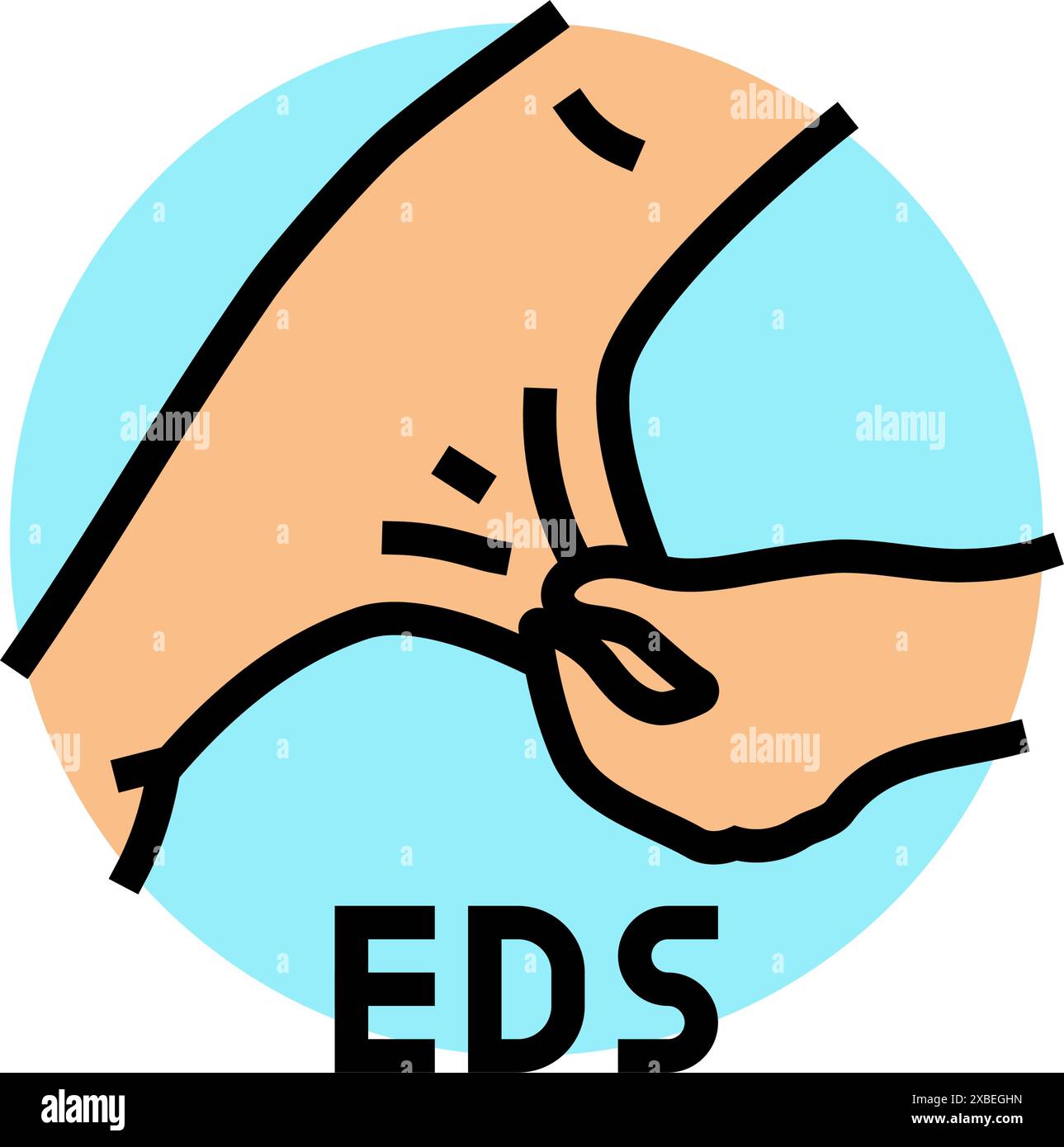 Ehlers danlos syndrome disease hi-res stock photography and images - Alamy