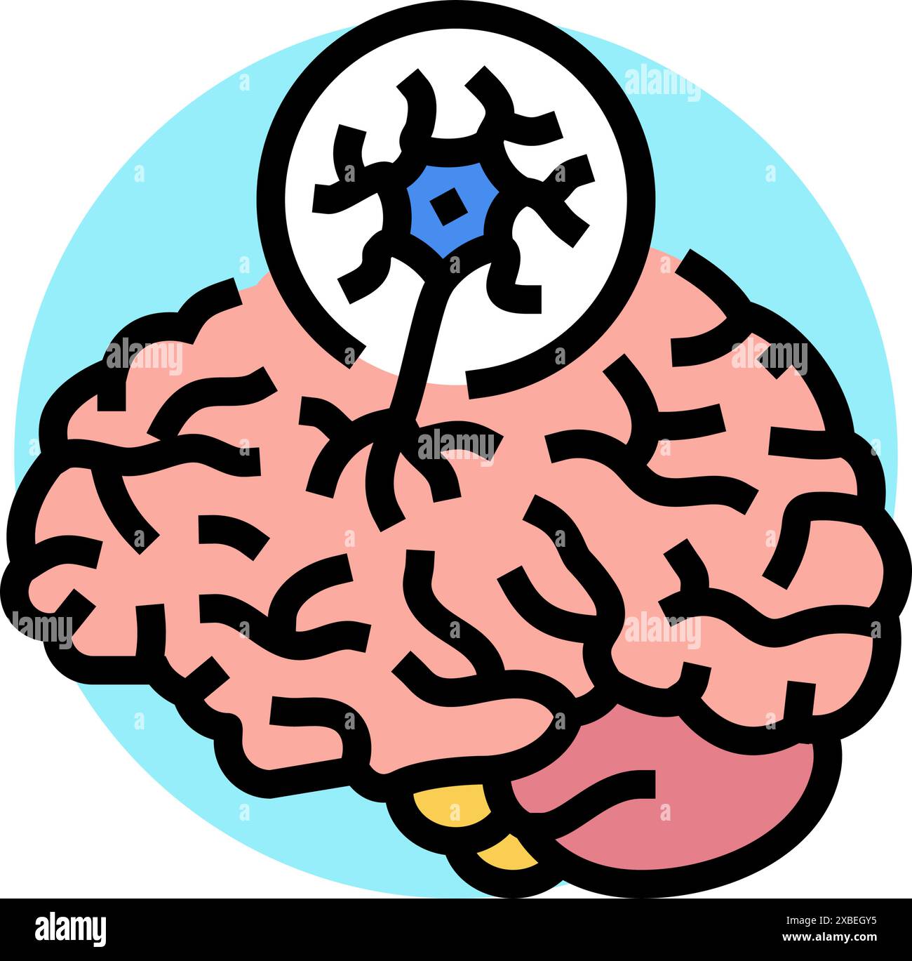 tay sachs disease color icon vector illustration Stock Vector Image ...