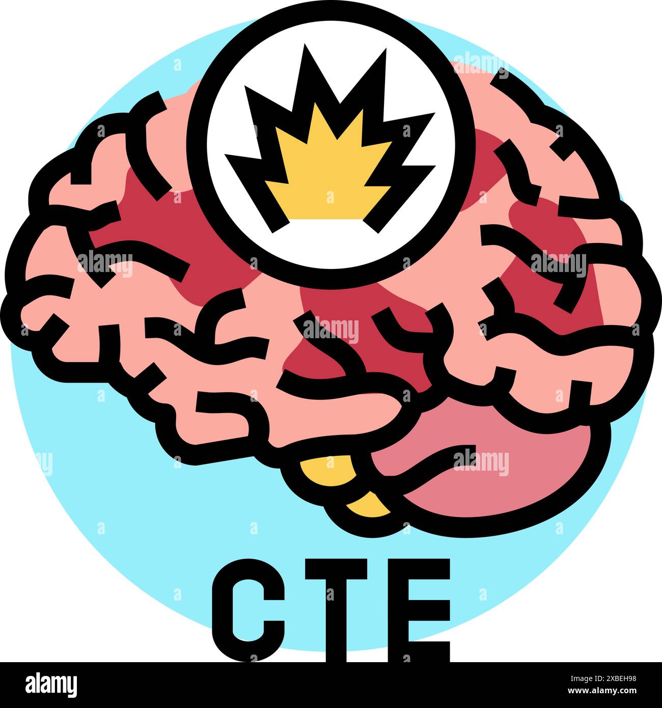 chronic traumatic encephalopathy color icon vector illustration Stock ...