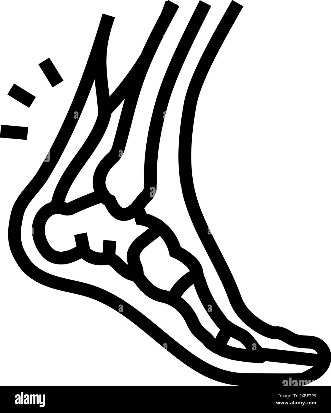 sprain household injury accident line icon vector illustration Stock ...