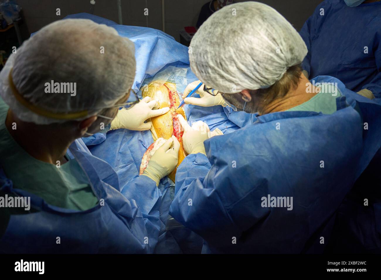Surgeons performing a precise incision during surgery Stock Photo - Alamy
