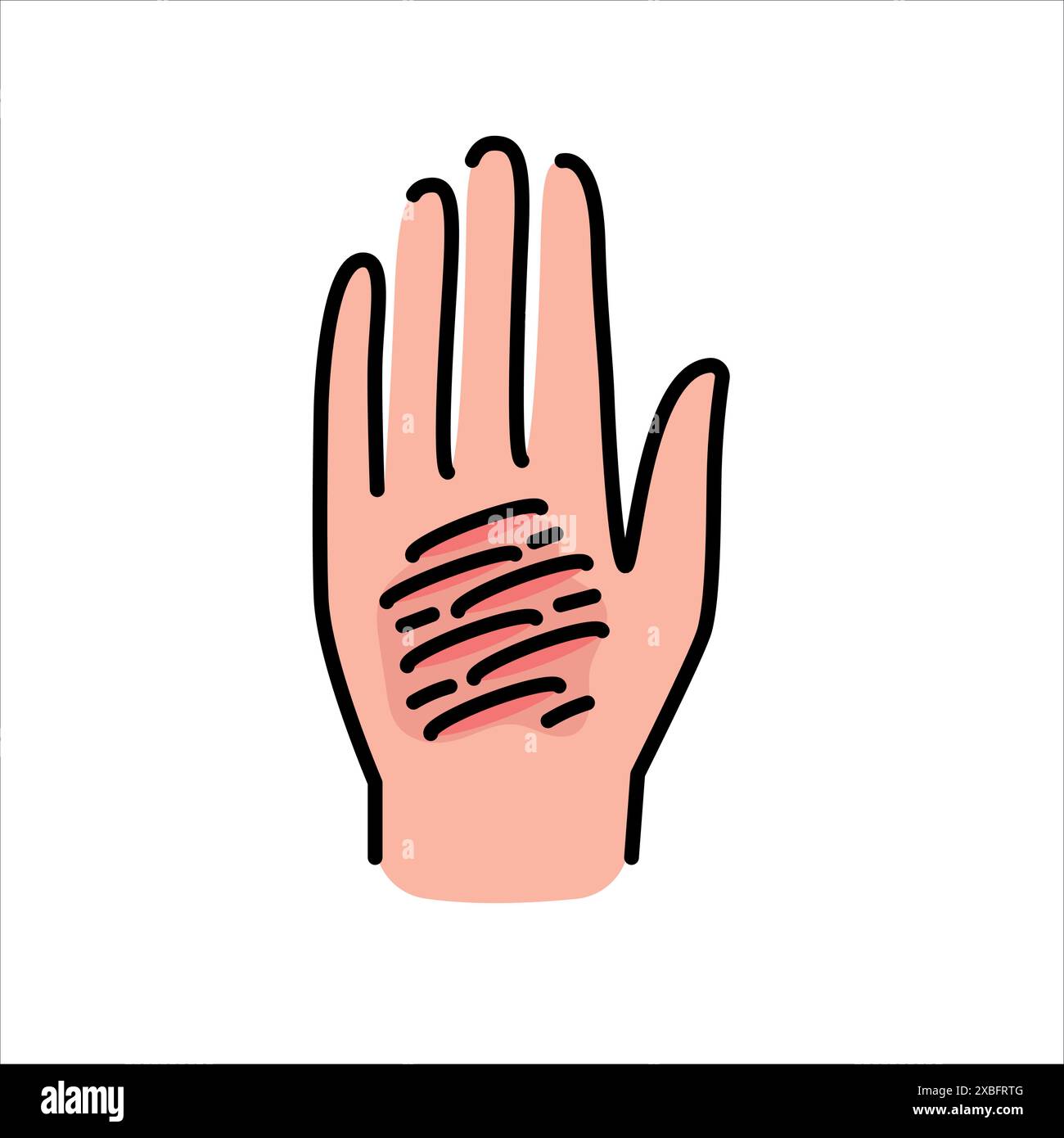Arm abrasion accident Stock Vector Images - Alamy