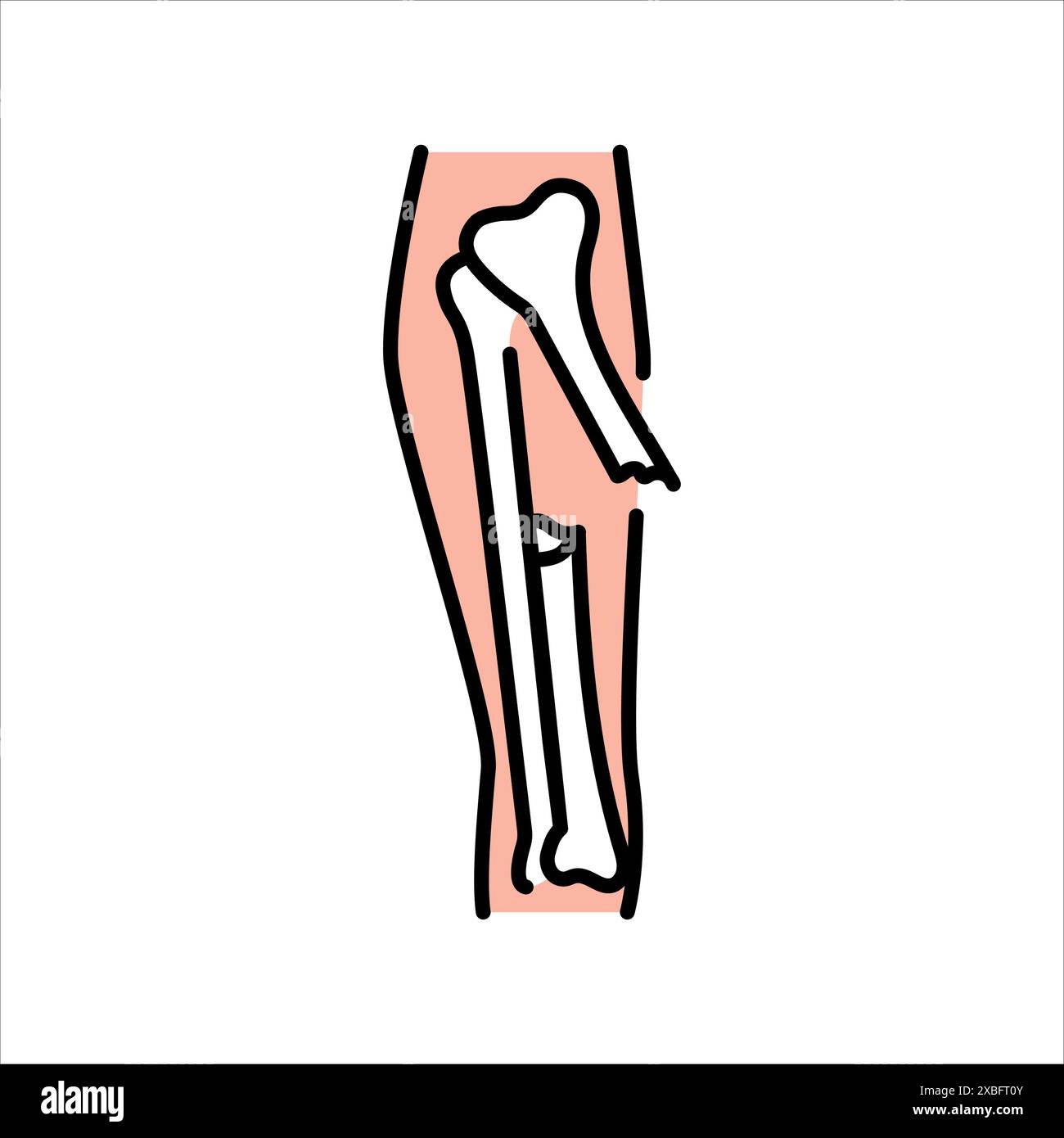 Bone fractures line color icon. Household injuries sign for web page ...