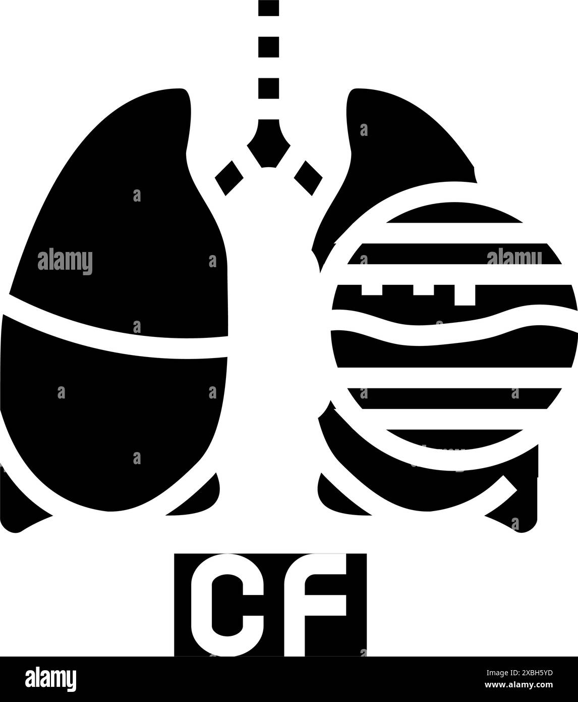 Cystic Fibrosis Disease Glyph Icon Vector Illustration Stock Vector