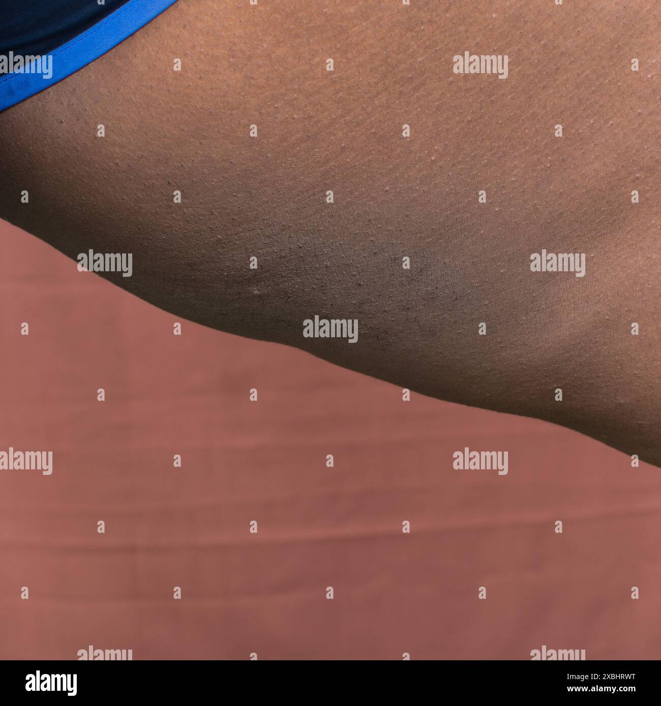 Dark inner thigh on brown skin, hyperpigmentation and darkening of ...