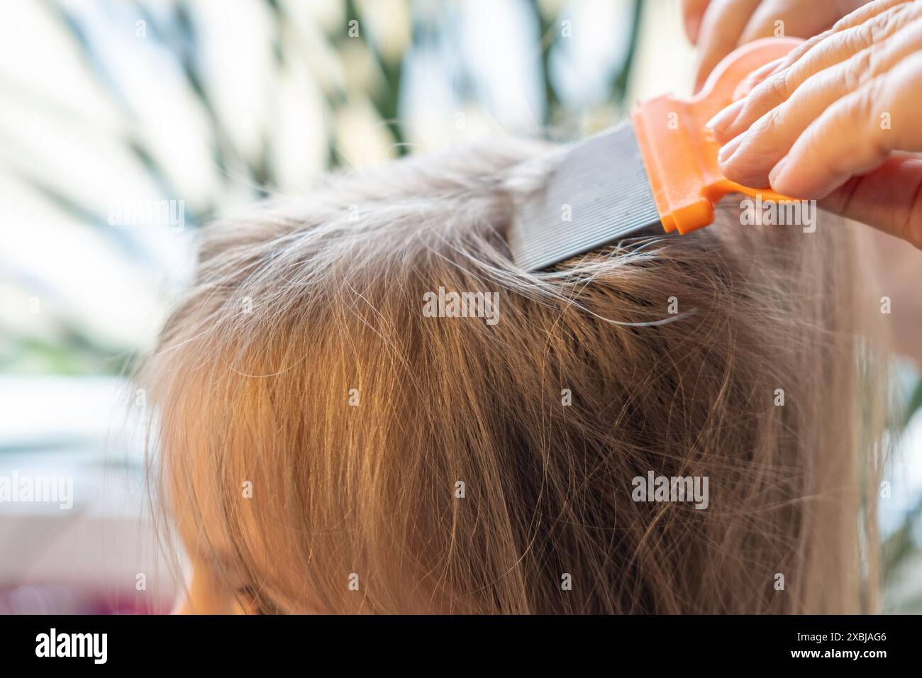 Close-up child's head with female hands searching for lice and nits in ...