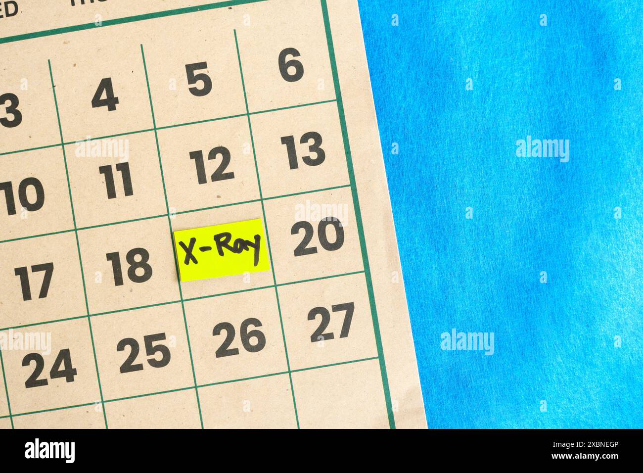 X-ray schedule concept. Written reminder note on calendar Stock Photo ...