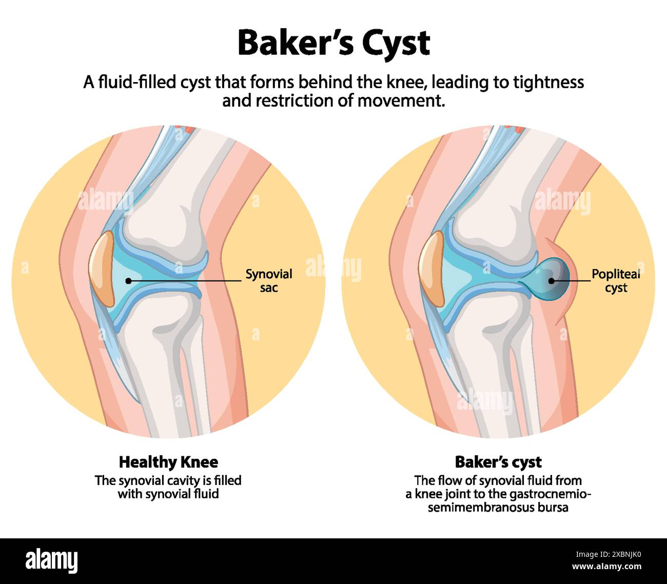 Synovial sac Stock Vector Images - Alamy