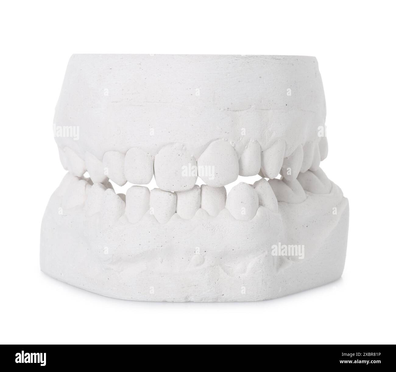 Dental model with gums isolated on white. Cast of teeth Stock Photo - Alamy