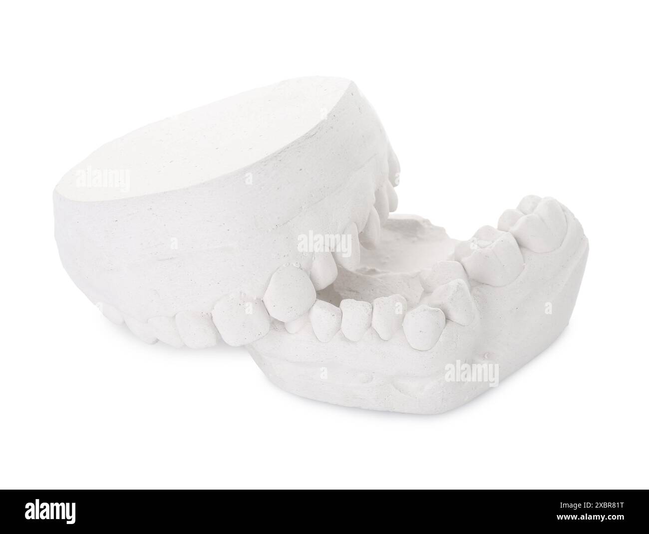 Dental model with gums isolated on white. Cast of teeth Stock Photo - Alamy