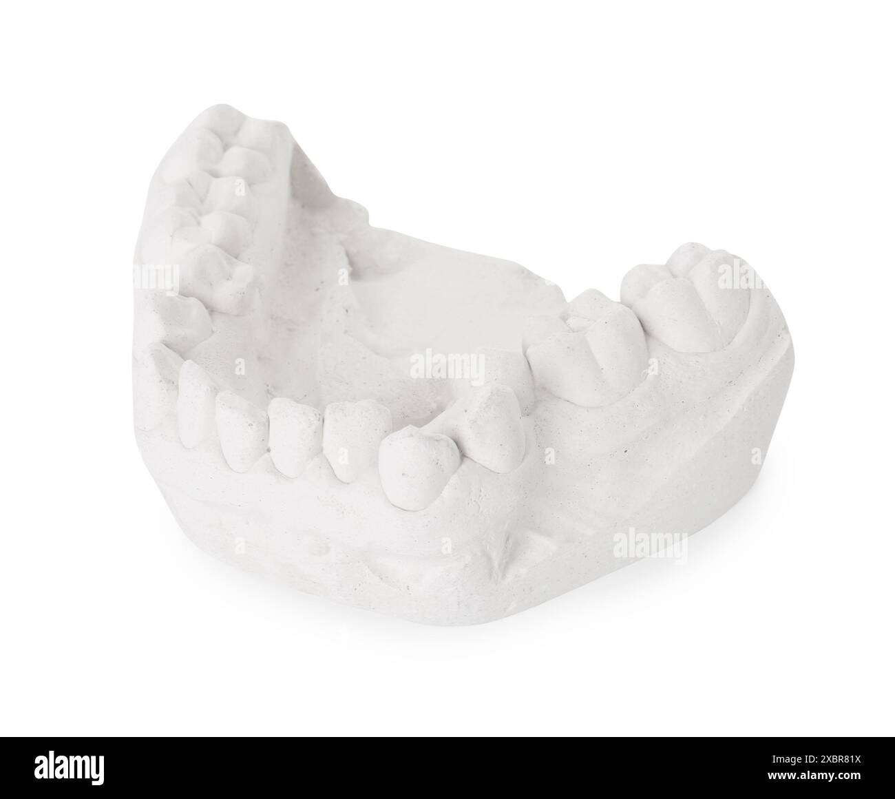 Dental model with gum isolated on white. Cast of teeth Stock Photo - Alamy