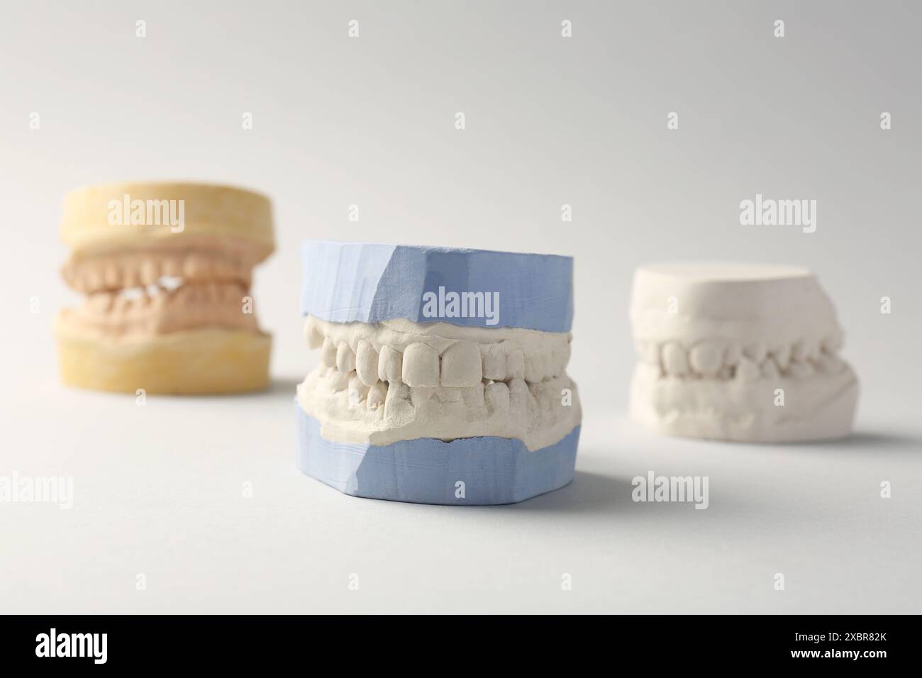 Dental models with gums on gray background. Cast of teeth Stock Photo ...