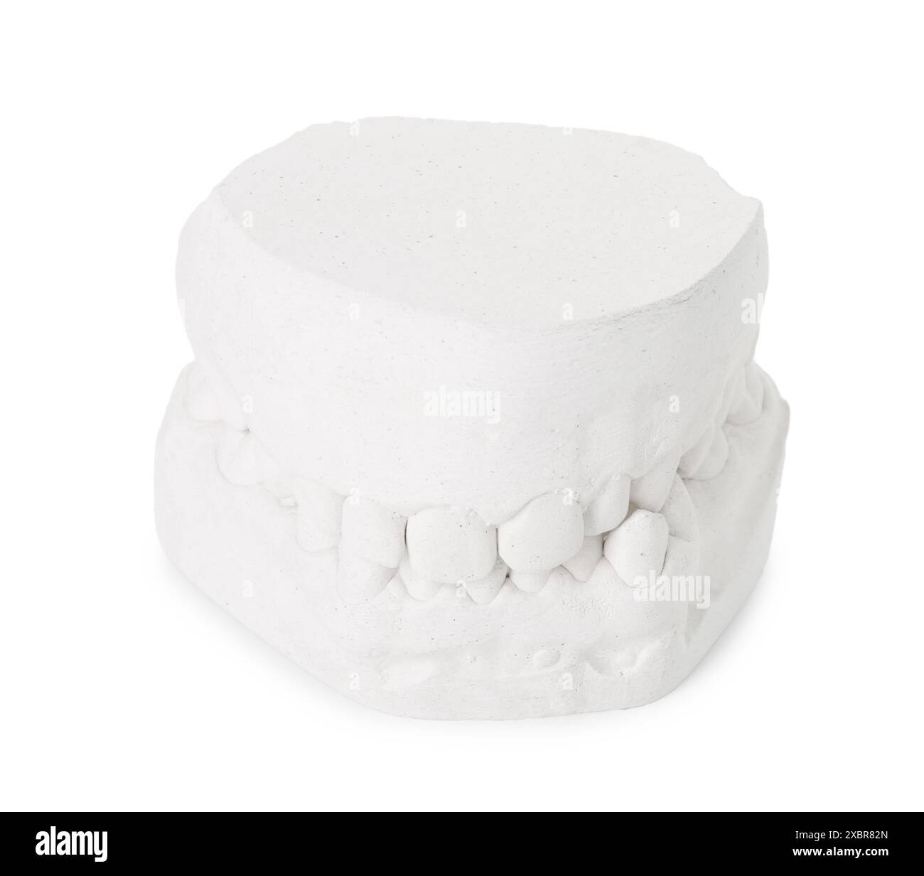 Dental model with gums isolated on white. Cast of teeth Stock Photo - Alamy