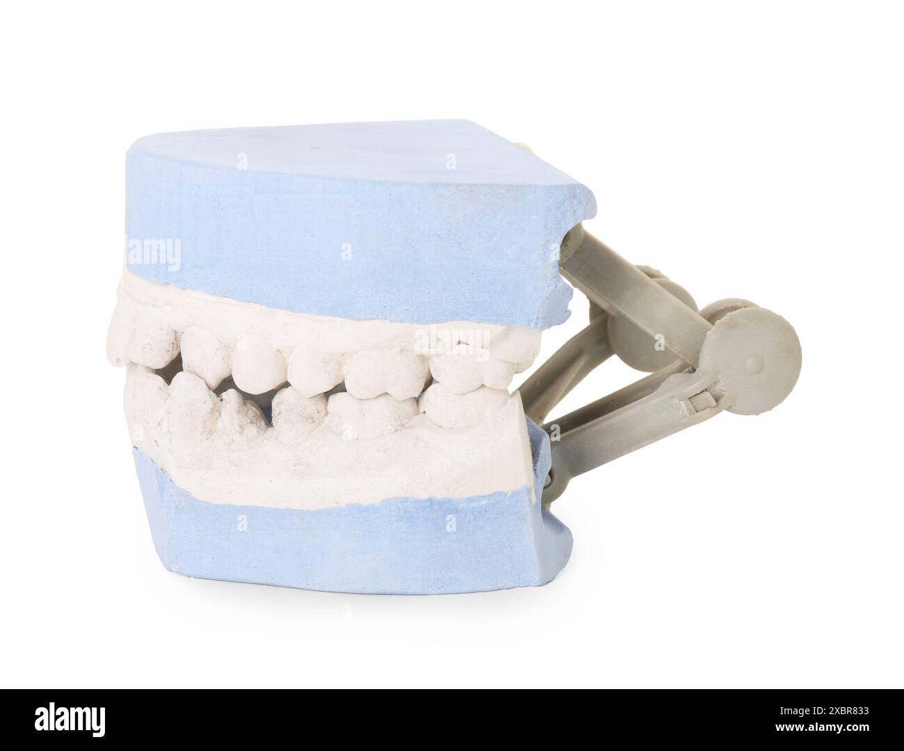 Dental model with gums isolated on white. Cast of teeth Stock Photo - Alamy
