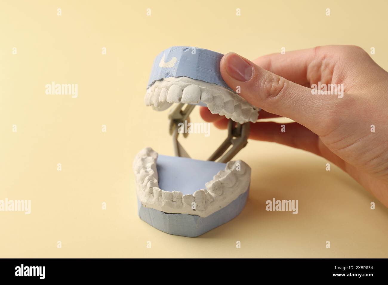 Woman holding dental model with gums on yellow background, closeup ...