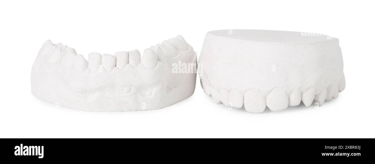 Dental model with gums isolated on white. Cast of teeth Stock Photo - Alamy