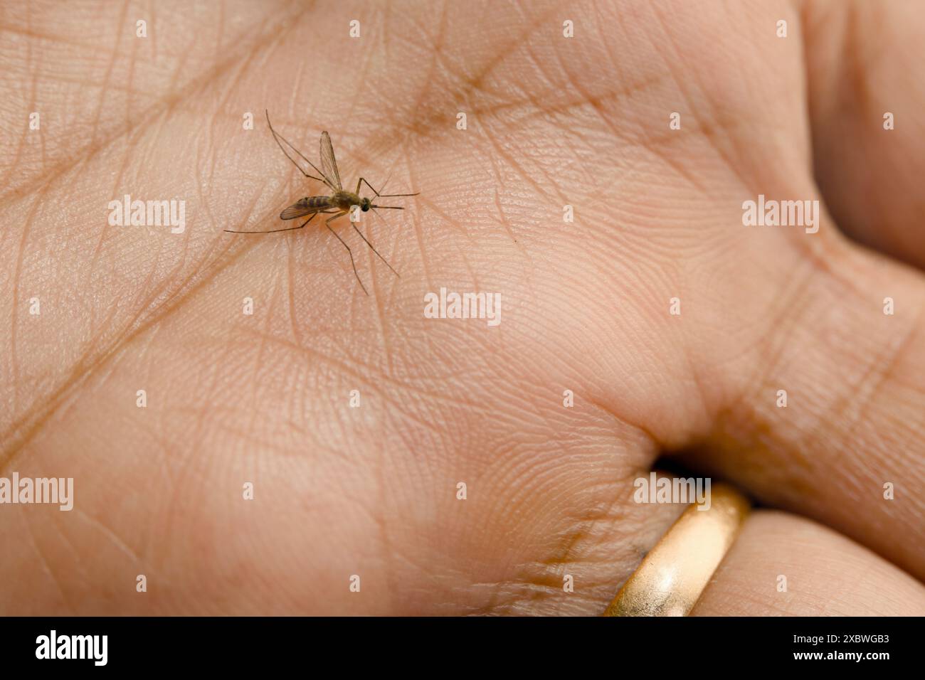 Biting prevention hi-res stock photography and images - Alamy