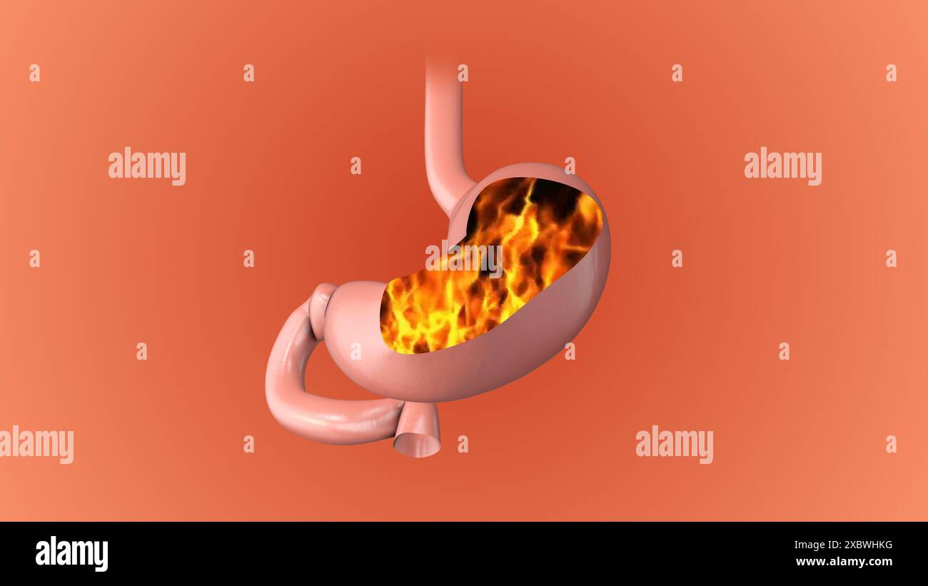 Stomach ache and a burning sensation Stock Photo - Alamy