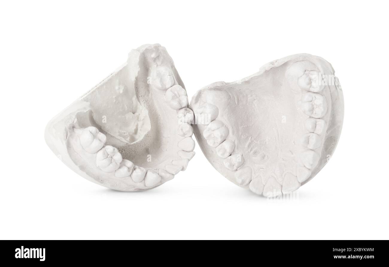 Dental model with jaws isolated on white. Cast of teeth Stock Photo - Alamy