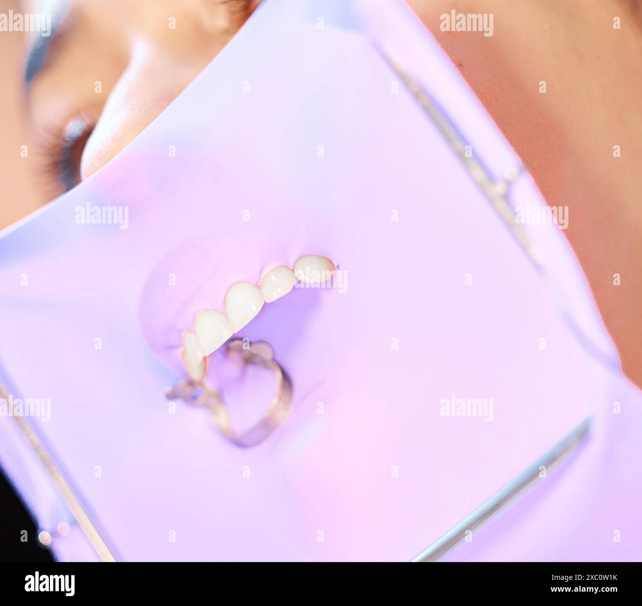 Woman, teeth and dental procedure at clinic with patients mouth covered ...