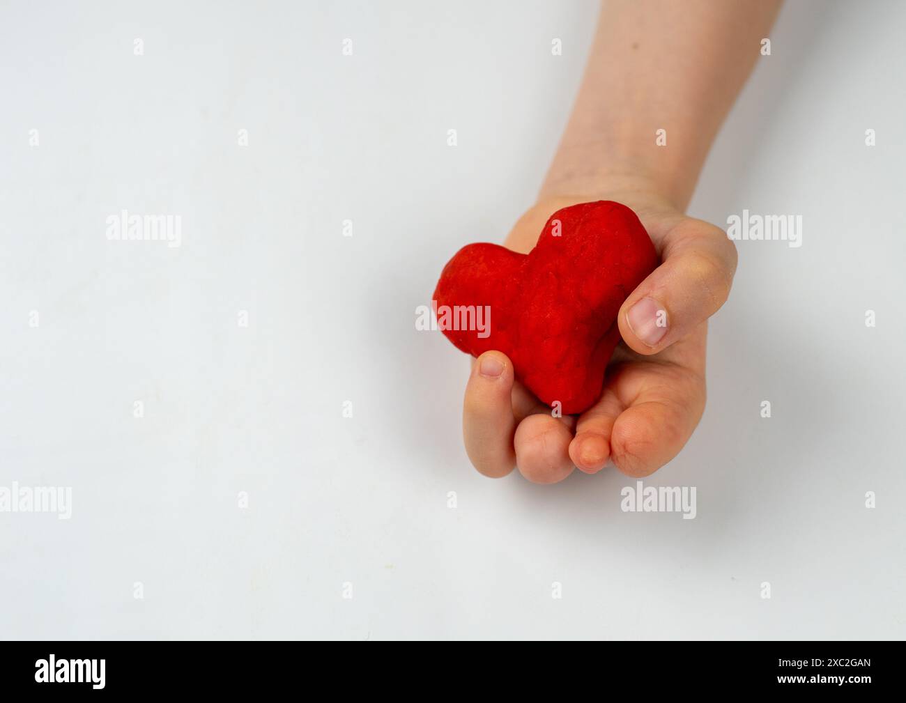 Sindrome Della Banda Amniotica Mano