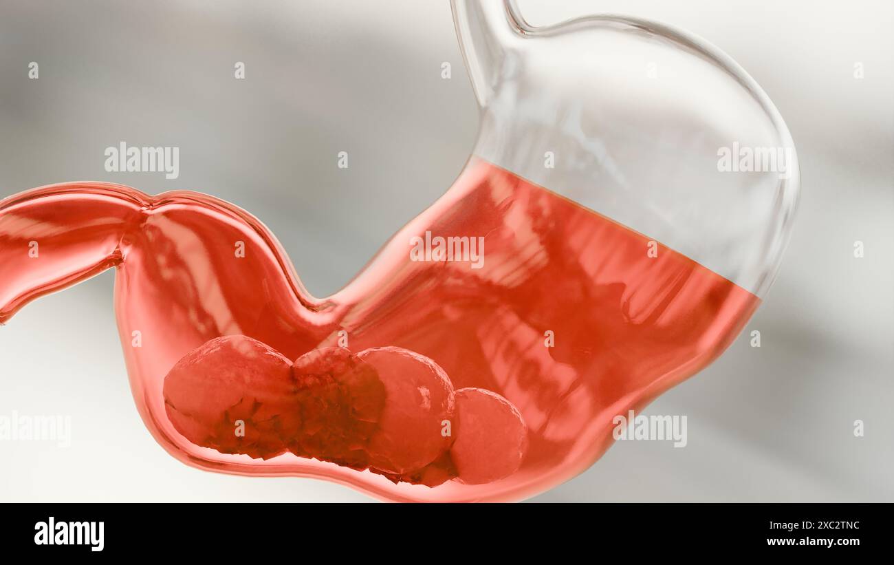 Human Stomach Anatomy Digestion, esophagus abdomen gastric with acid ...