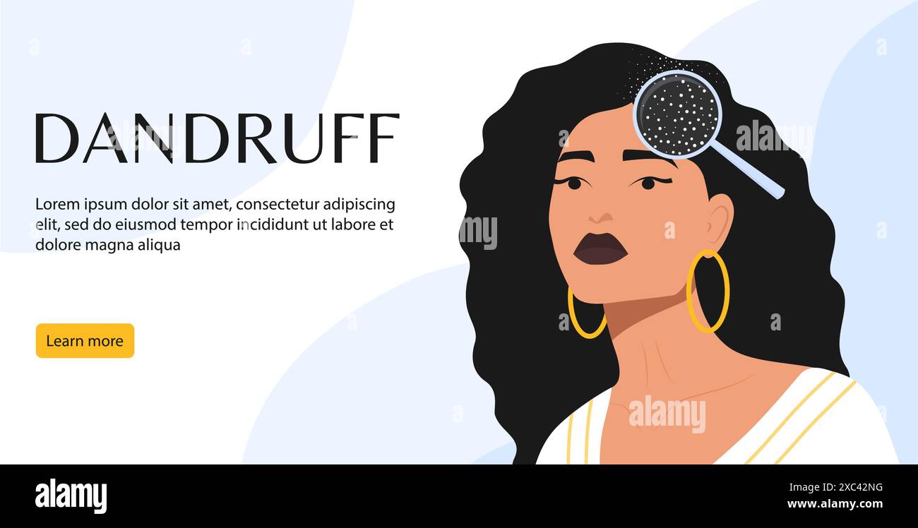 Womens dandruff problem on the head banner. Hair scalp problem. Fungal ...