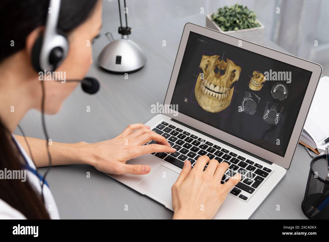 3d scan procedure hi-res stock photography and images - Alamy