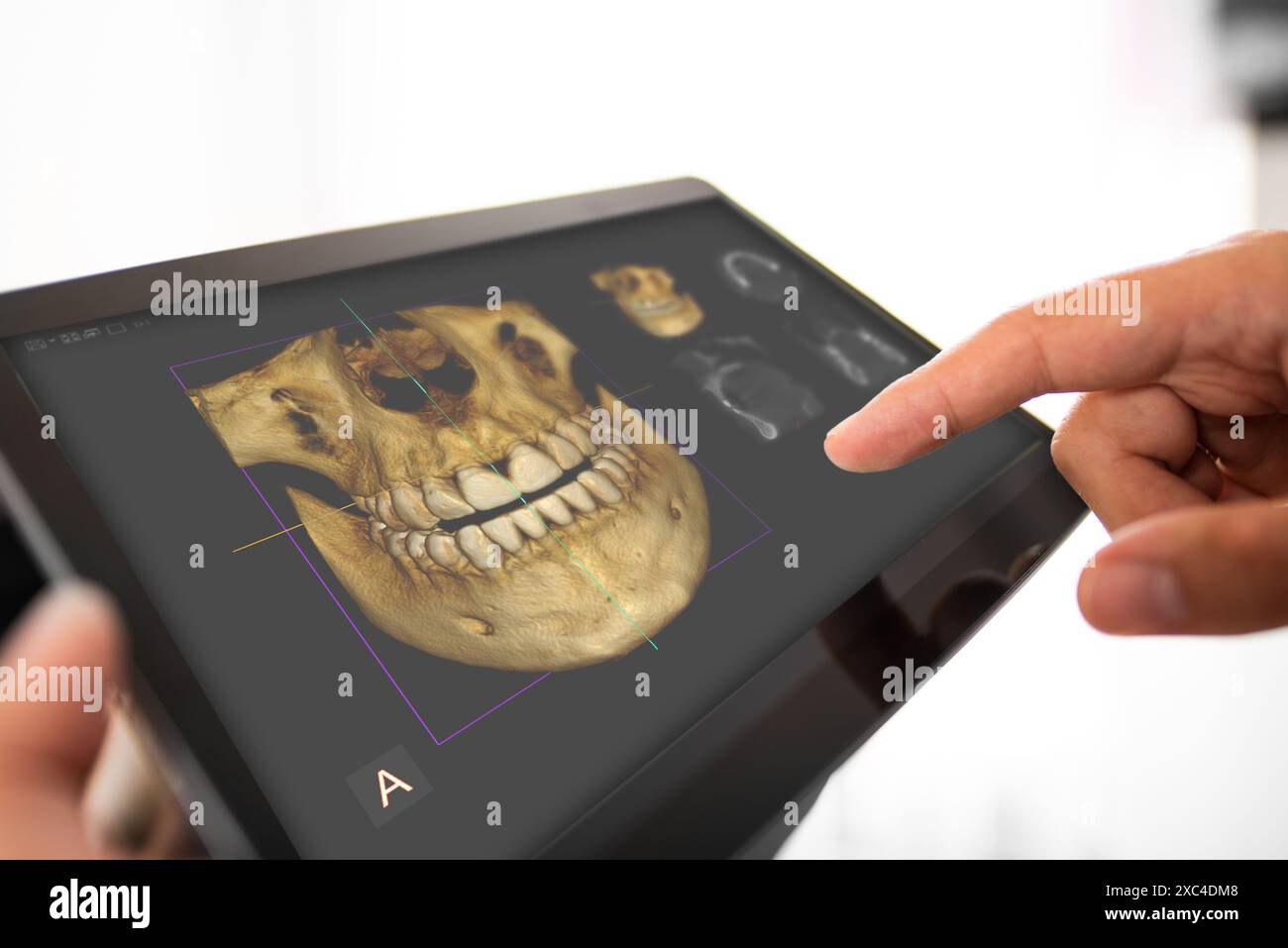 3d scan procedure hi-res stock photography and images - Alamy