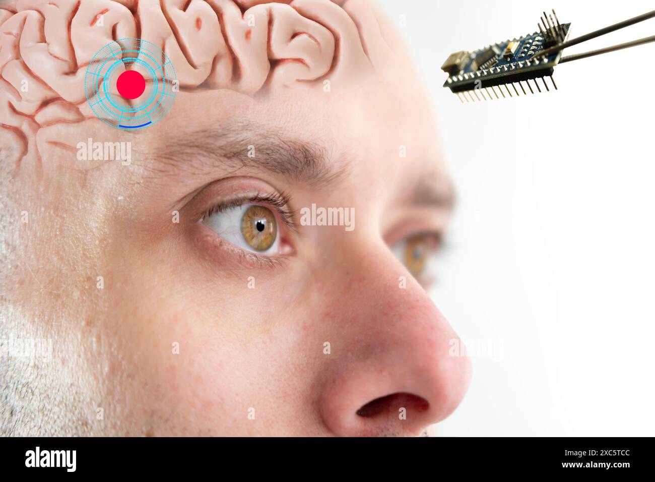 Installing electronic chip into human brain, applied in various fields ...