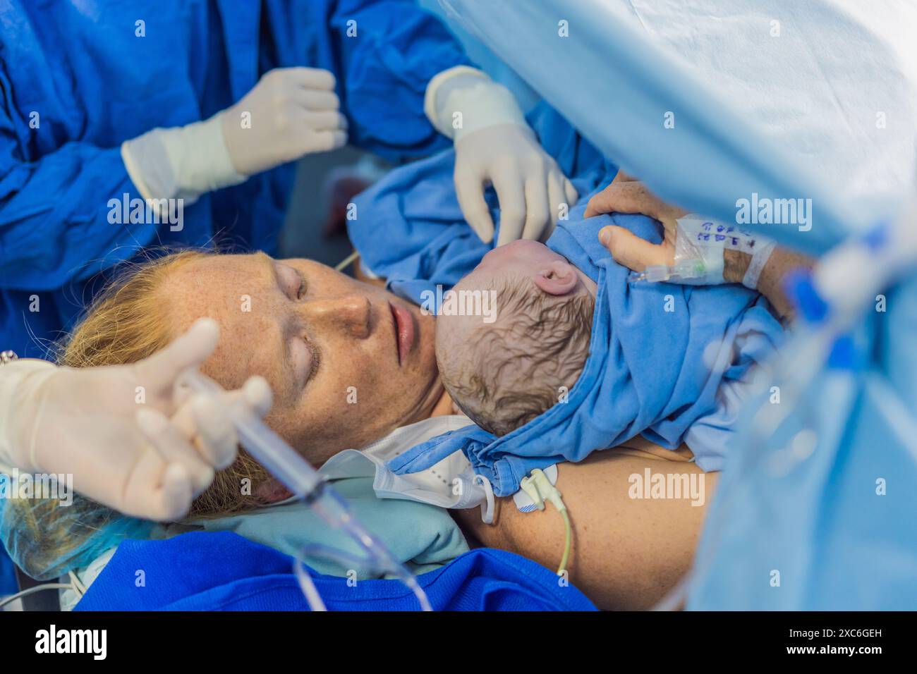 Baby on mother's chest immediately after birth in a hospital. The ...