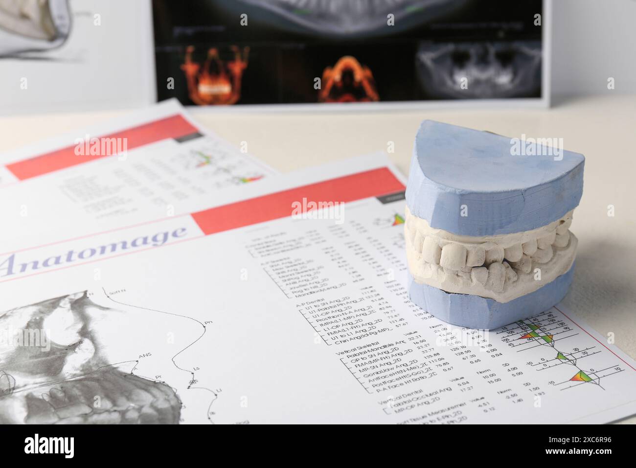 Dental model with gums, anatomy charts and panoramic x-ray on table ...